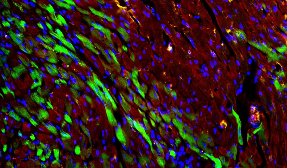 Pacemaker Researchers Swap Batteries for Biology - Science Friday