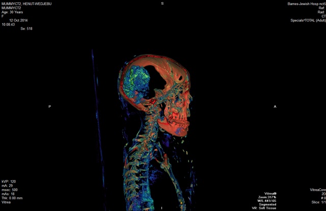 Gift of the Mummy - Science Friday