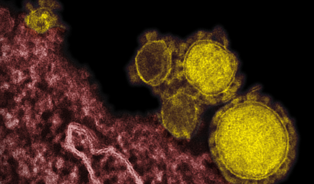 MERS Virus Update - Science Friday