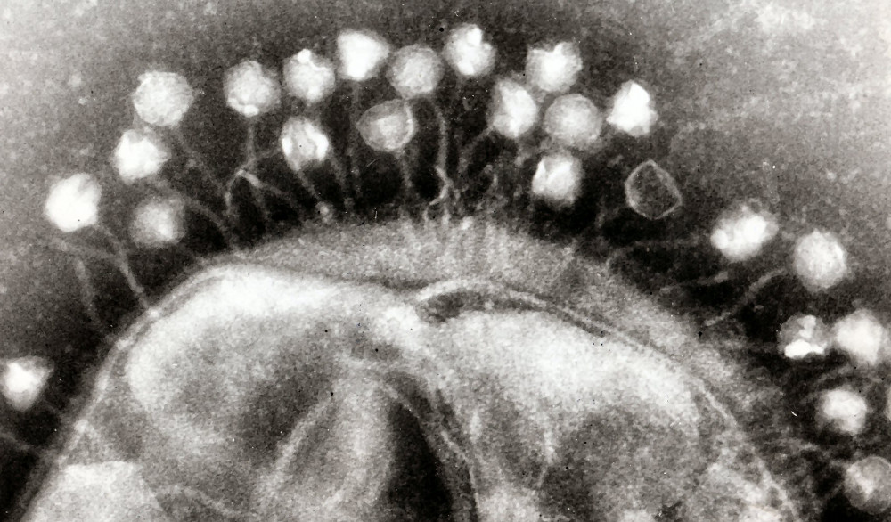 Busting Bad Bacteria With Their Viral Enemies - Science Friday