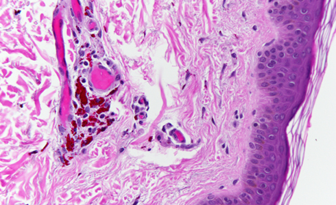 Picture of the Week: Death Under Glass