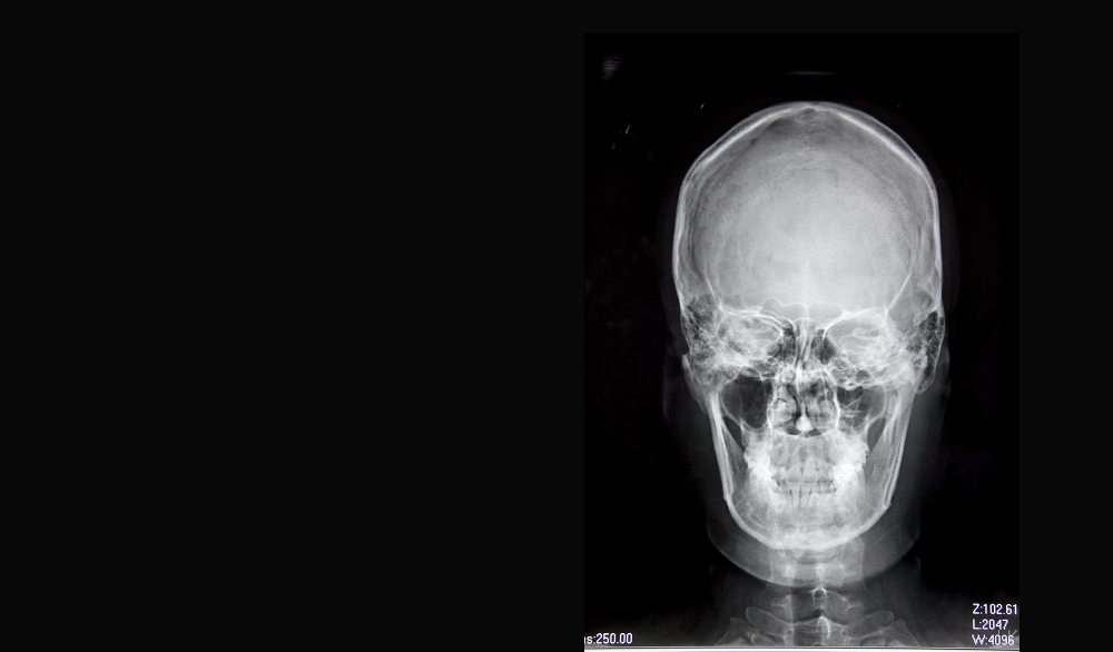 Meet the Brains Behind 'Bones' - Science Friday Meet the Brains Behind 'Bones' - Science Friday