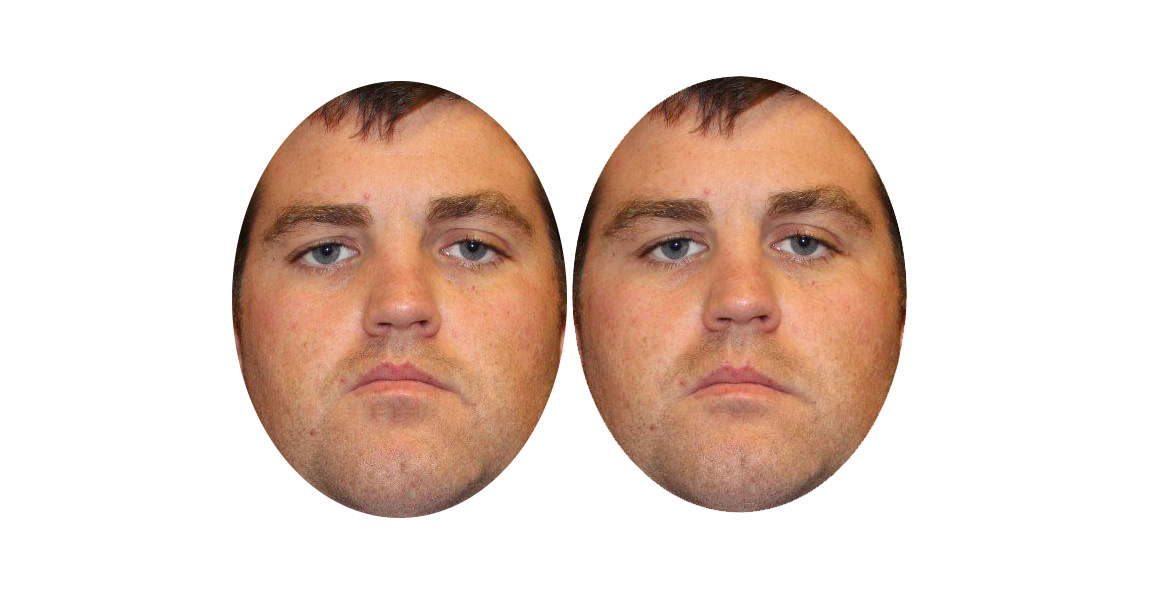 What Is Face Blindness? - Science Friday