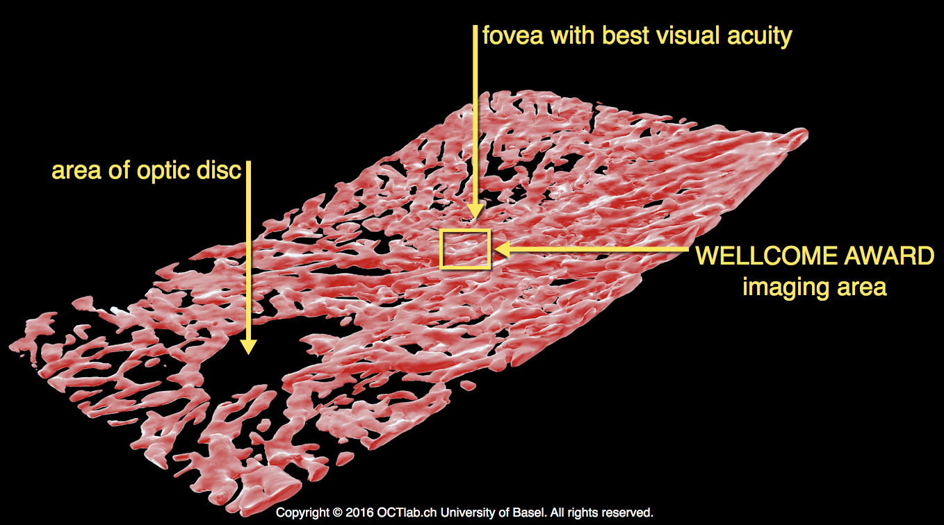 Seeing Inside The Eye