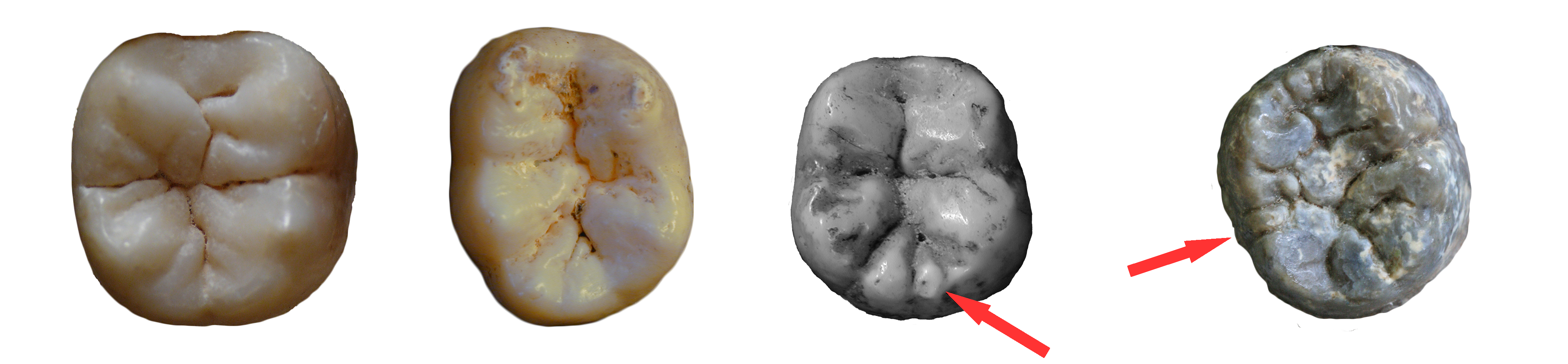 The Wisdom Of Teeth - Science Friday