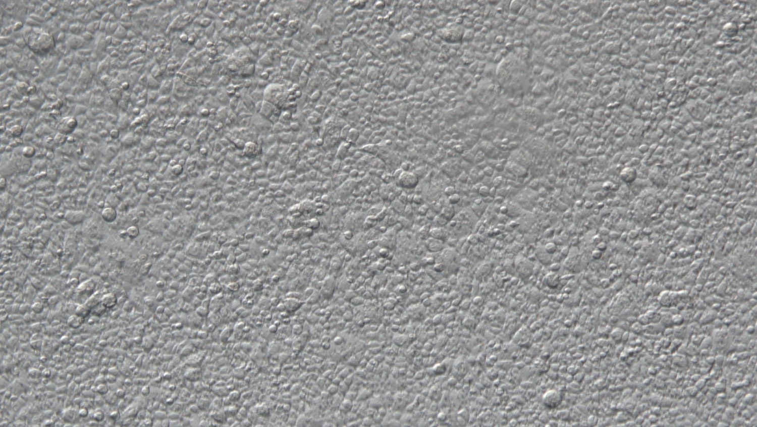 New Technique Uses Stem Cells To Treat Cornea Damage