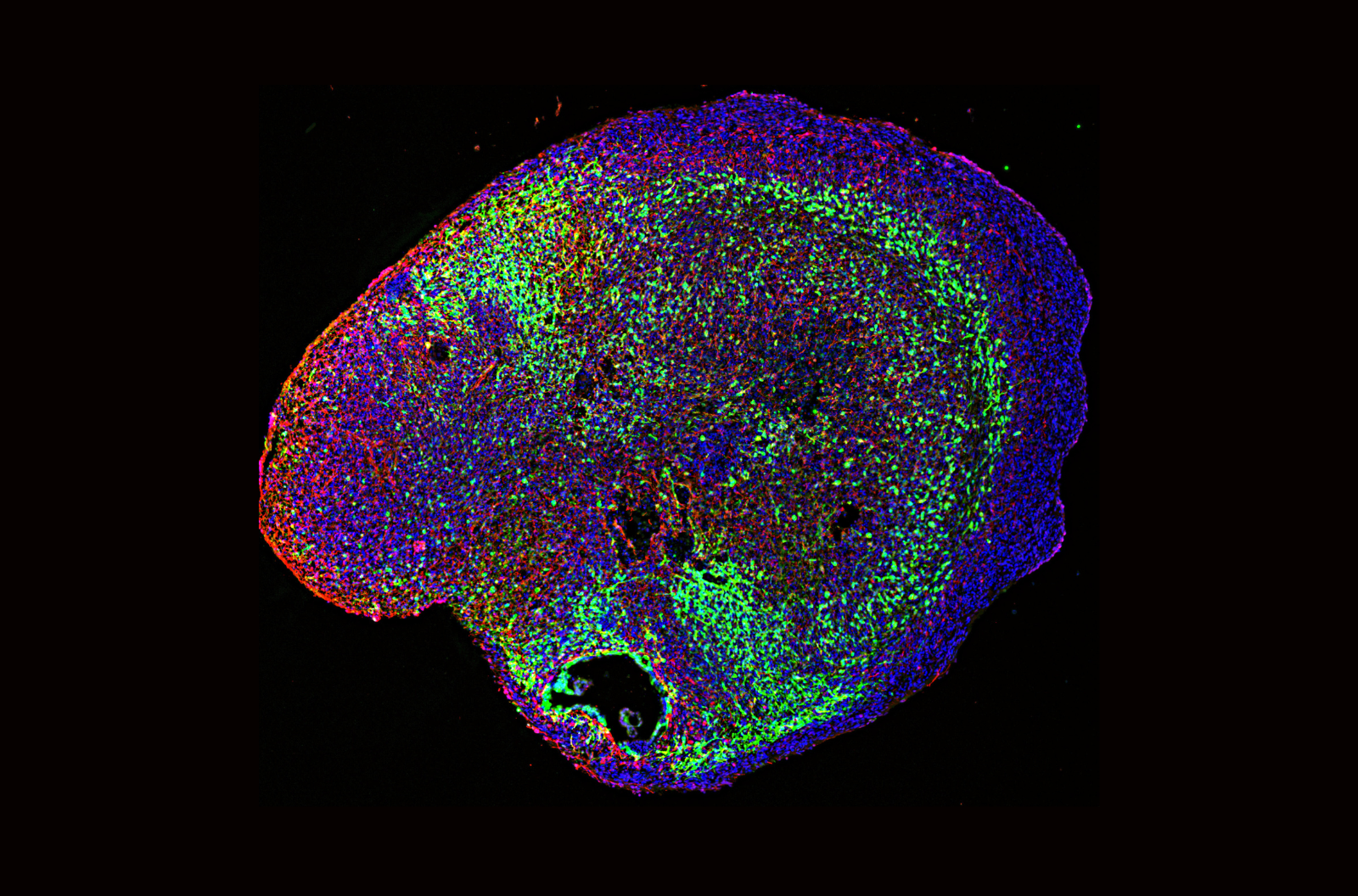 Brain ‘Organoids’: Lab-Grown Cell Clusters Model Brain Functions Brain ‘Organoids’: Lab-Grown Cell Clusters Model Brain Functions