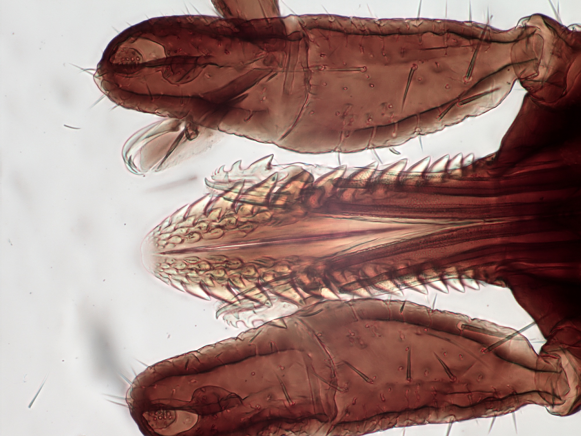 Instead Of A Vaccine For Lyme, How About A Vaccine For Ticks?