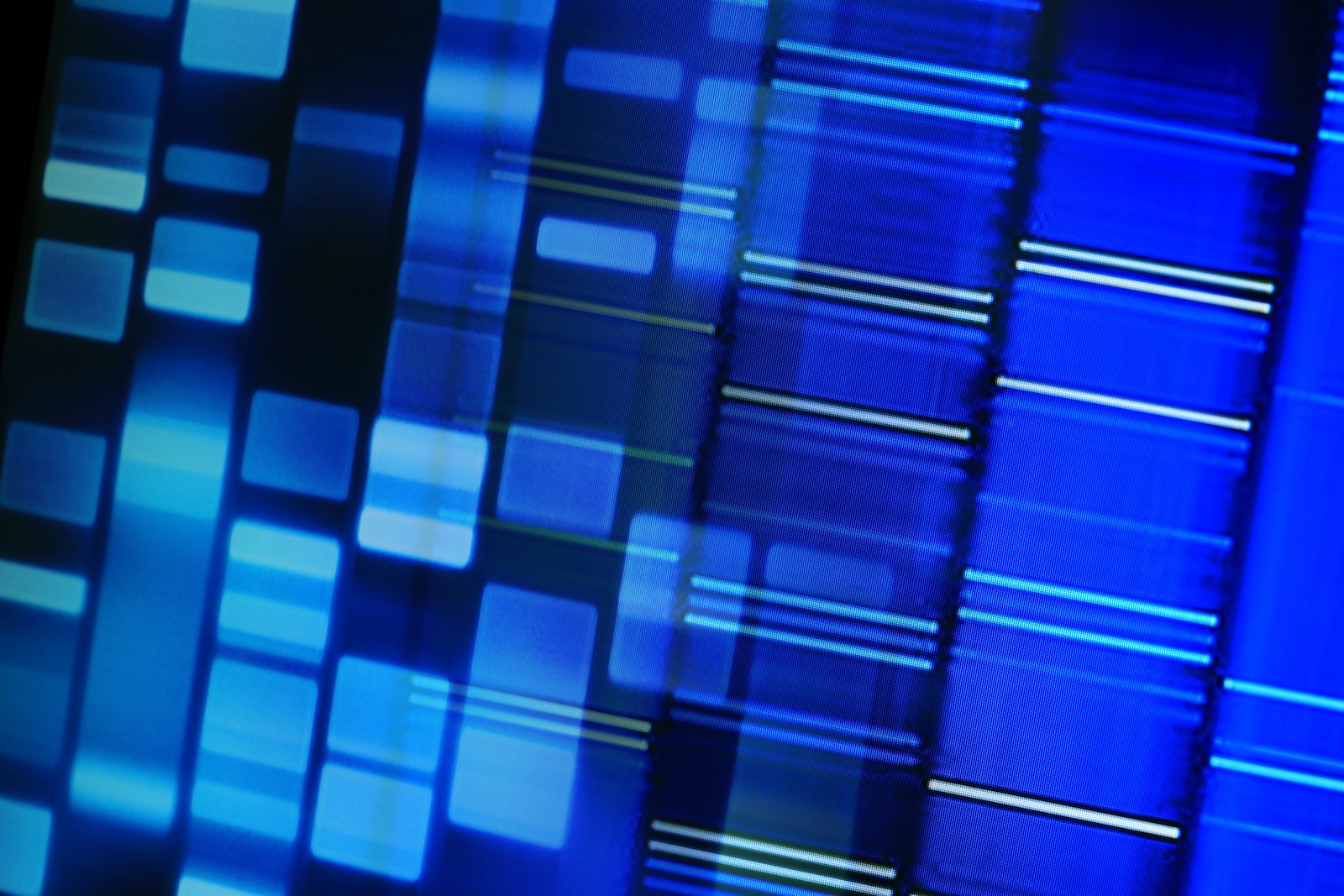 How One Gene Affects Alzheimer’s Risk